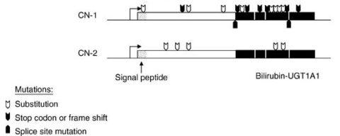 Crigler-Najjar Syndromes - The Medical Biochemistry Page